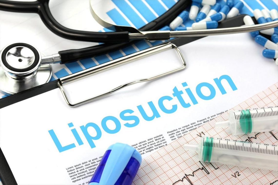 Liposuction: What is it? - Your Health 321 : Great health coach